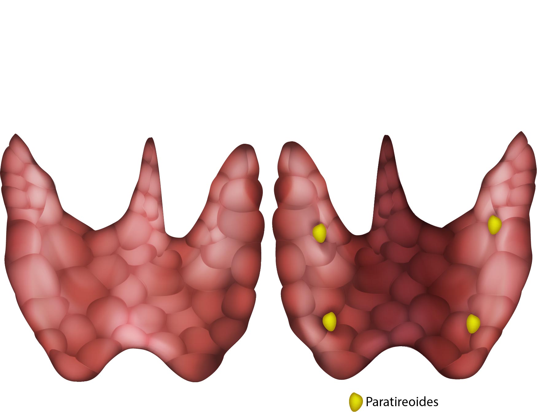 Arquivos Paratireoides | Dra. Suzana Vieira - Endocrinologista