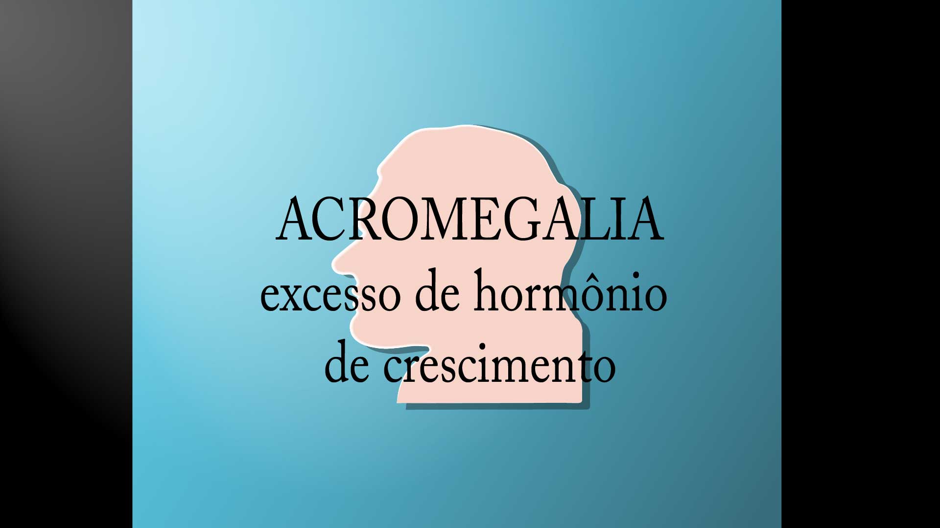 Acromegalia - excesso do hormônio de crescimento no adulto - Dra ...